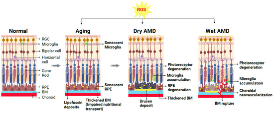 Oxidative Stress and Antioxidants in Age-Related Macular Degeneration