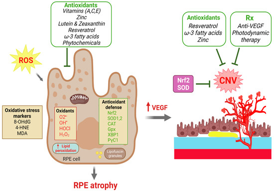 Oxidative Stress and Antioxidants in Age-Related Macular Degeneration