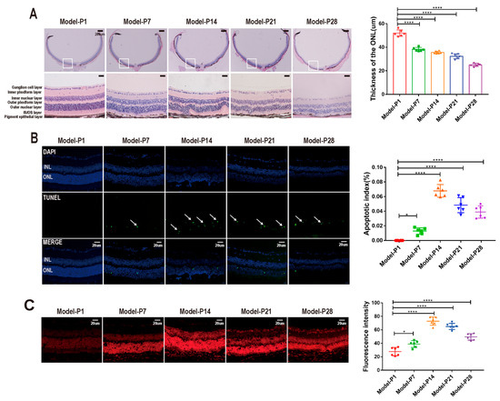 Intravitreal Injection of ZYAN1 Restored Autophagy and Alleviated ...
