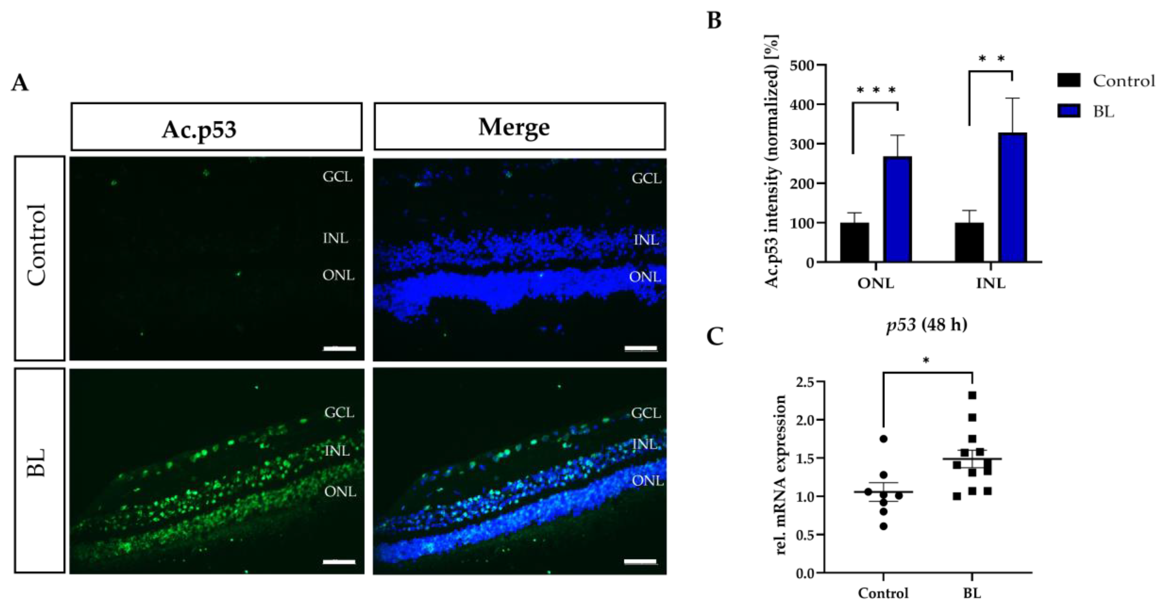 Blue Light Damage and p53: Unravelling the Role of p53 in Oxidative ...