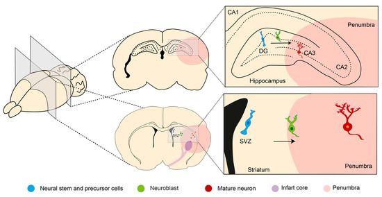 Antioxidant and Anti-Inflammatory Effects of Garlic in Ischemic Stroke ...