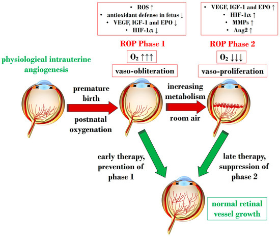 Retinopathy of Prematurity—Targeting Hypoxic and Redox Signaling Pathways