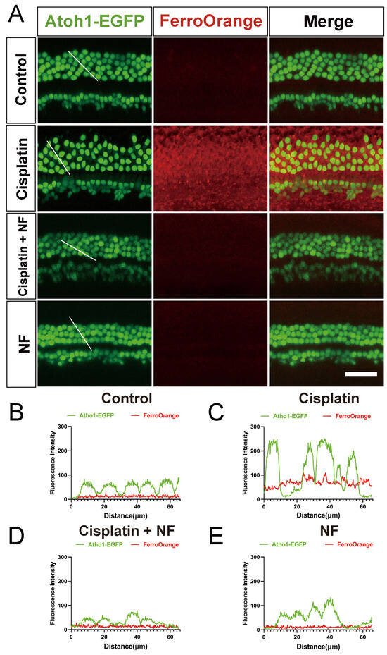 Nuciferine Protects Cochlear Hair Cells from Ferroptosis through ...