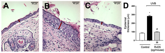 Antioxidants | Free Full-Text | Resolvin D5 Protects Female Hairless ...
