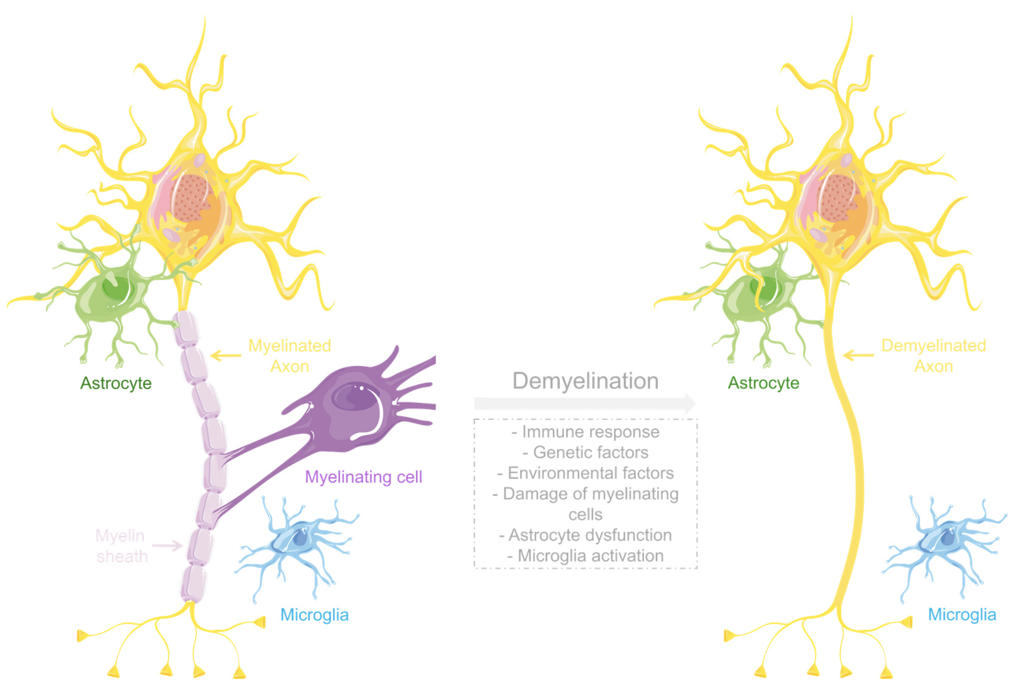 The Link Between Paraquat and Demyelination: A Review of Current Evidence