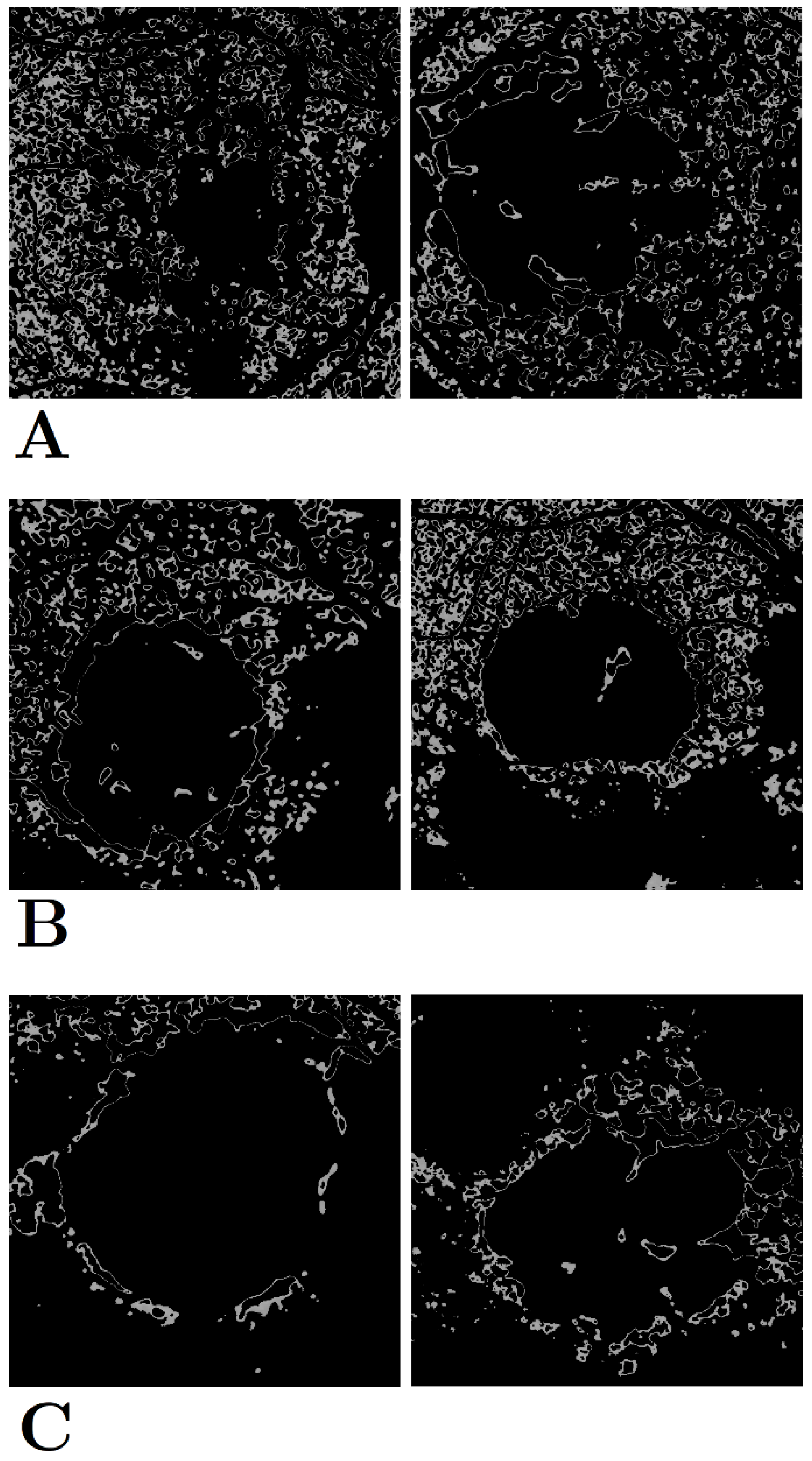 Automation of Cluster Extraction in Fundus Autofluorescence Images of ...
