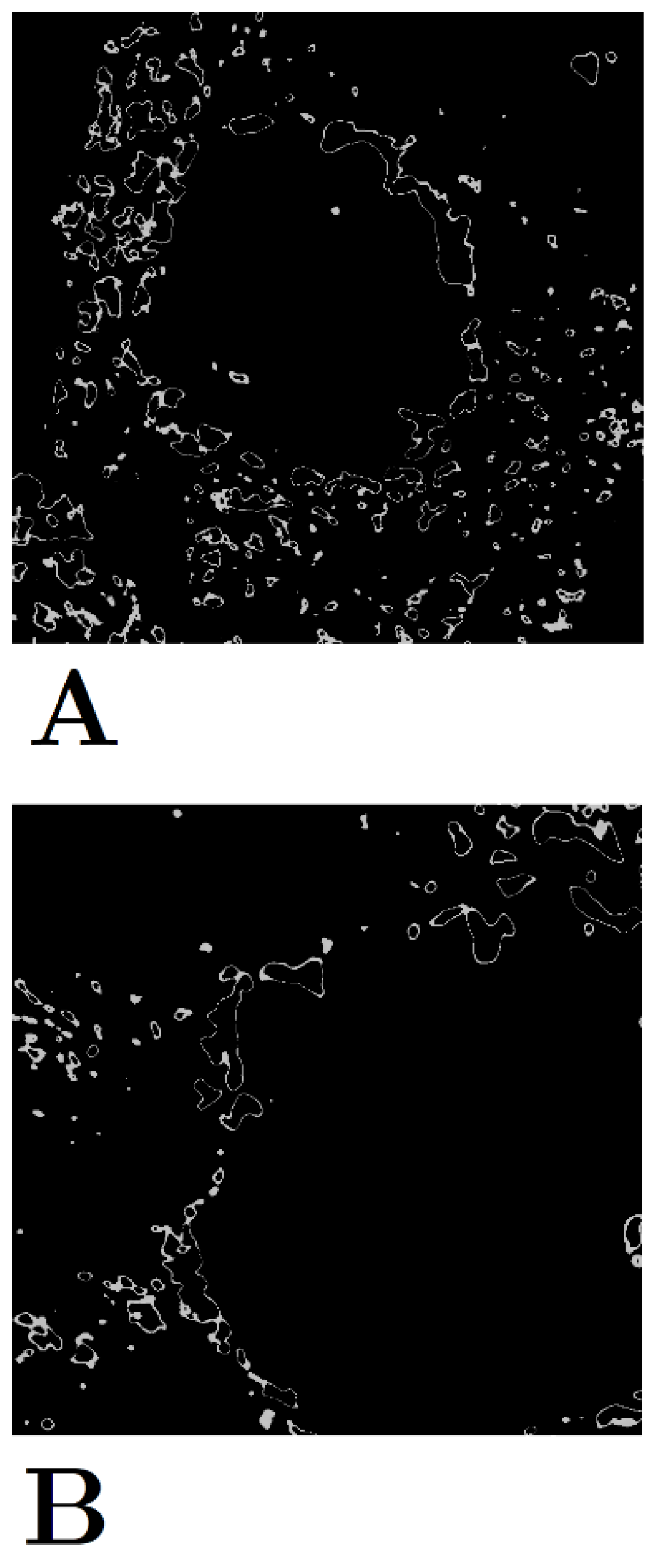 Automation of Cluster Extraction in Fundus Autofluorescence Images of ...
