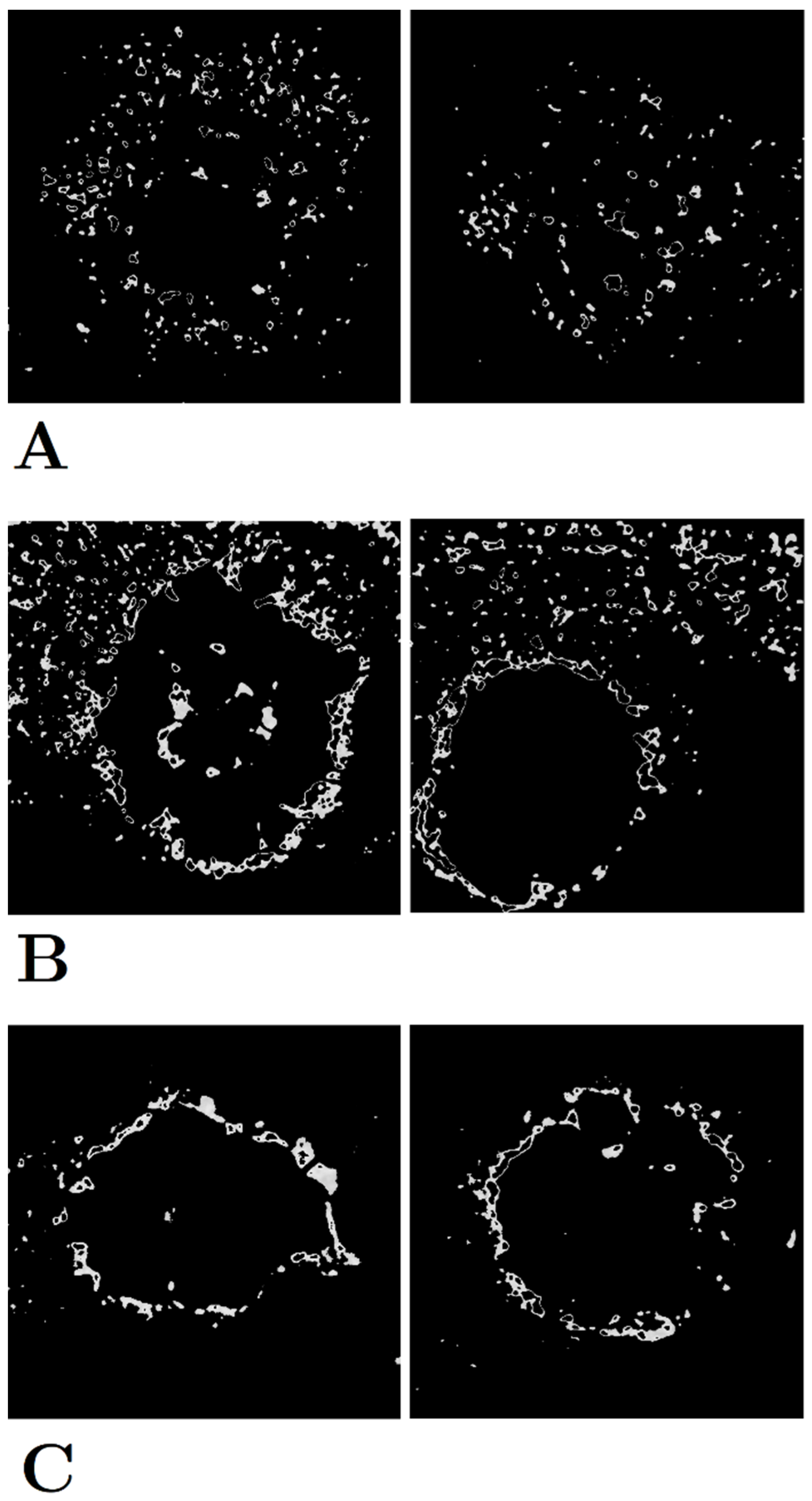 Automation of Cluster Extraction in Fundus Autofluorescence Images of ...