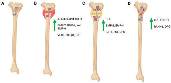 Distraction Osteogenesis: A Comprehensive Review