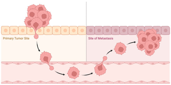 Mathematical Modeling of Cancer Progression