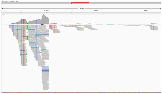 Forensic Analysis of Novel SARS2r-CoV Identified in Game Animal ...