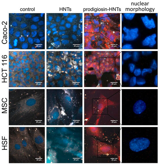 Bacterial Pigment Prodigiosin as Multifaceted Compound for Medical and ...