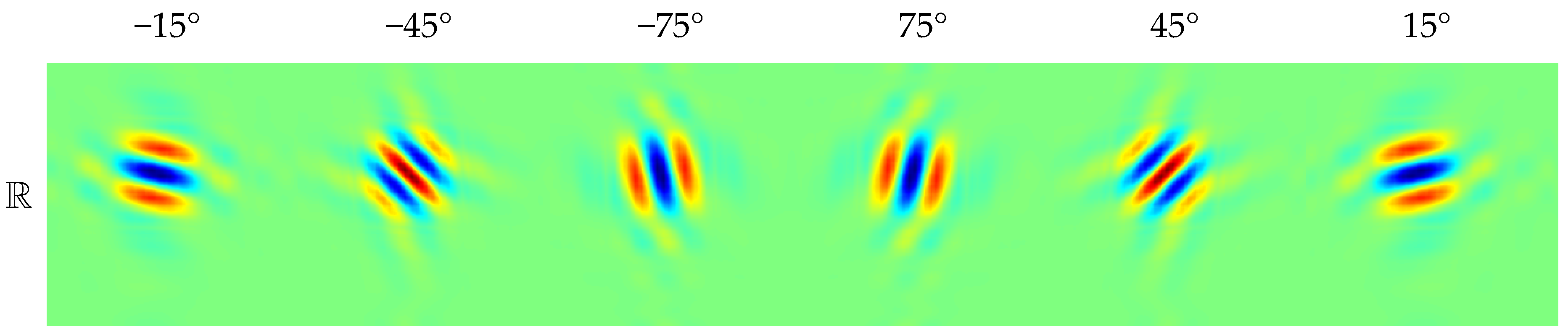 Dual-Tree Complex Wavelet Transform and Twin Support Vector Machine for Pathological Brain Detection