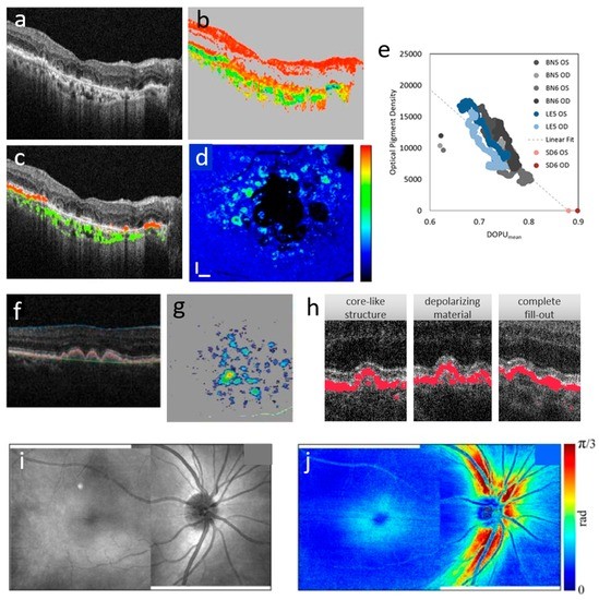 Polarization Sensitive Optical Coherence Tomography: A Review of Technology and Applications