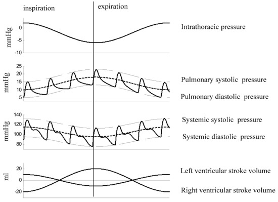 Discrimination of Aortic and Pulmonary Components from the Second Heart ...