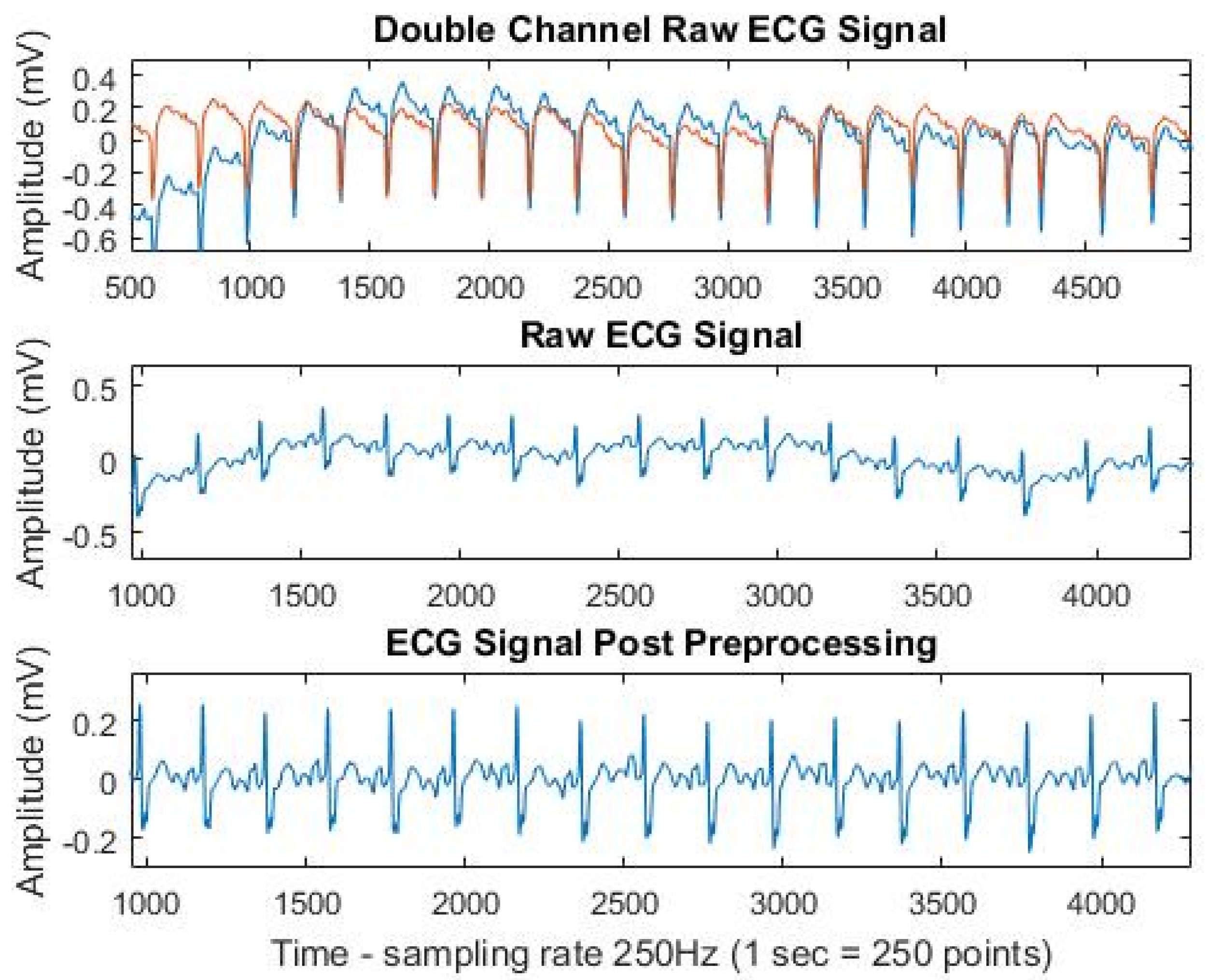 Computational Algorithms Underlying the Time-Based Detection of Sudden ...