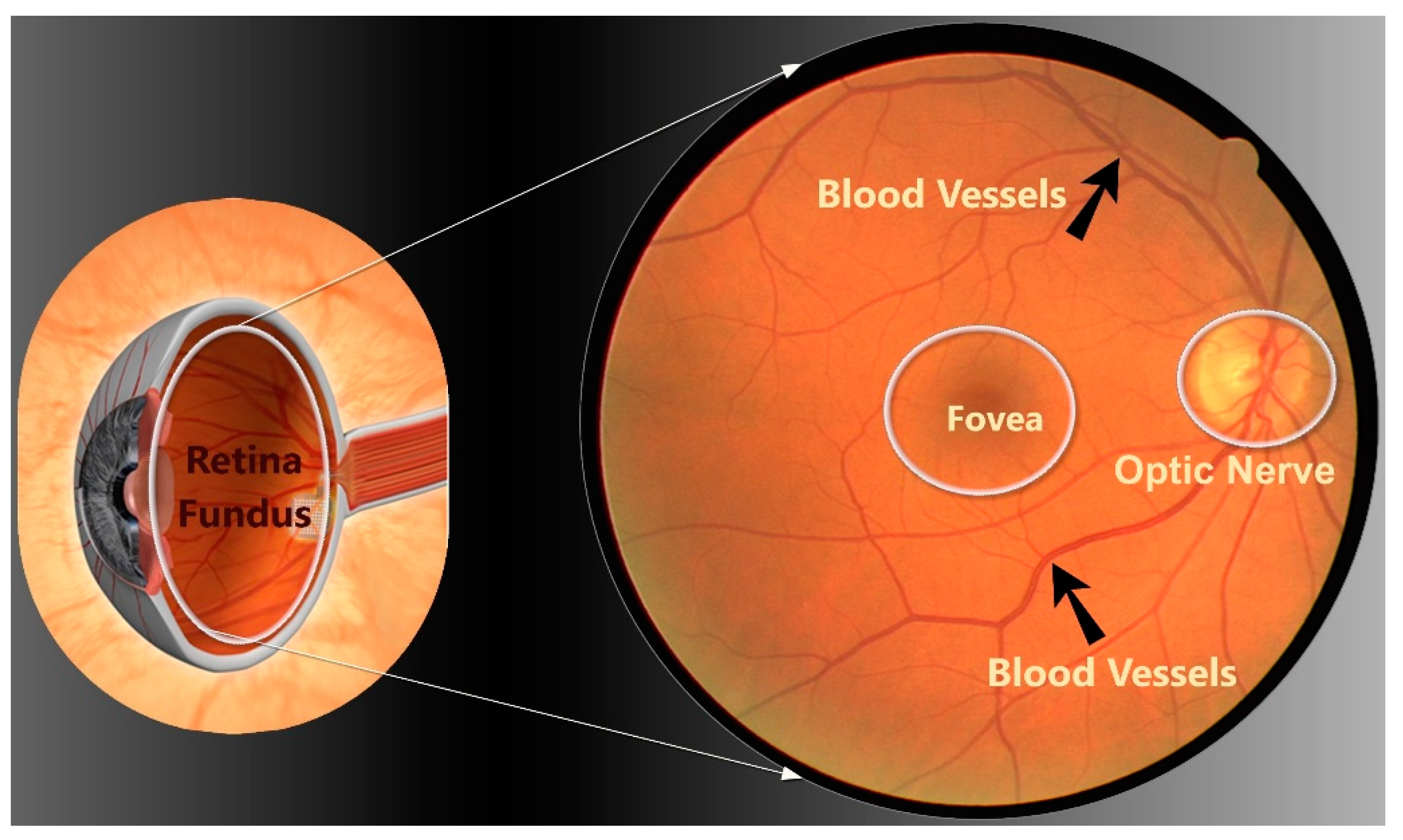 Retinal Vessels Segmentation Techniques and Algorithms: A Survey