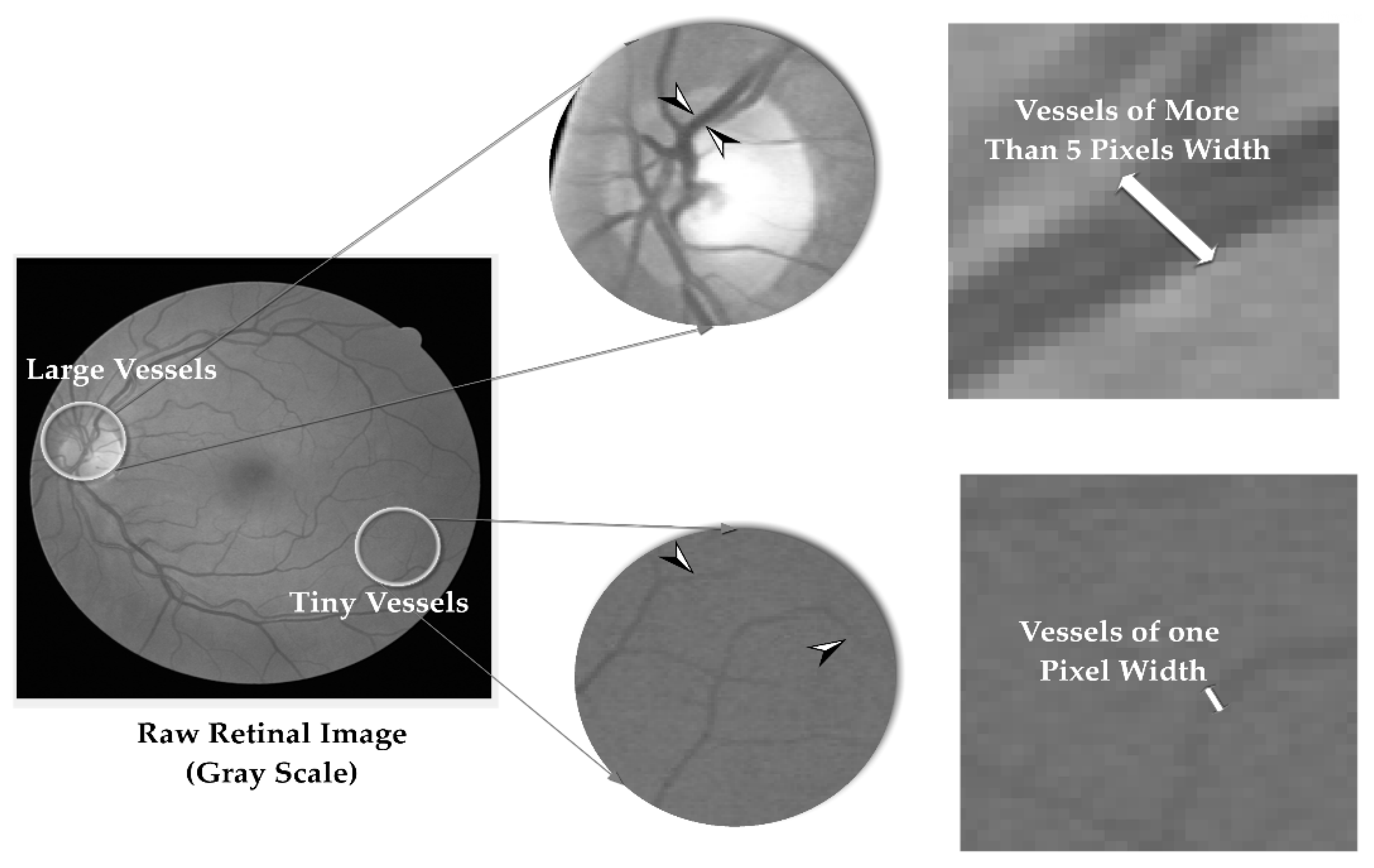 Process Of Retinal Vessel Segmentation Using Mlp Images Process Of Retinal Vessel Segmentation Using Mlp Images