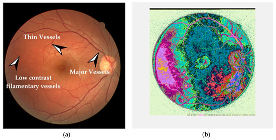 Retinal Vessels Segmentation Techniques and Algorithms: A Survey