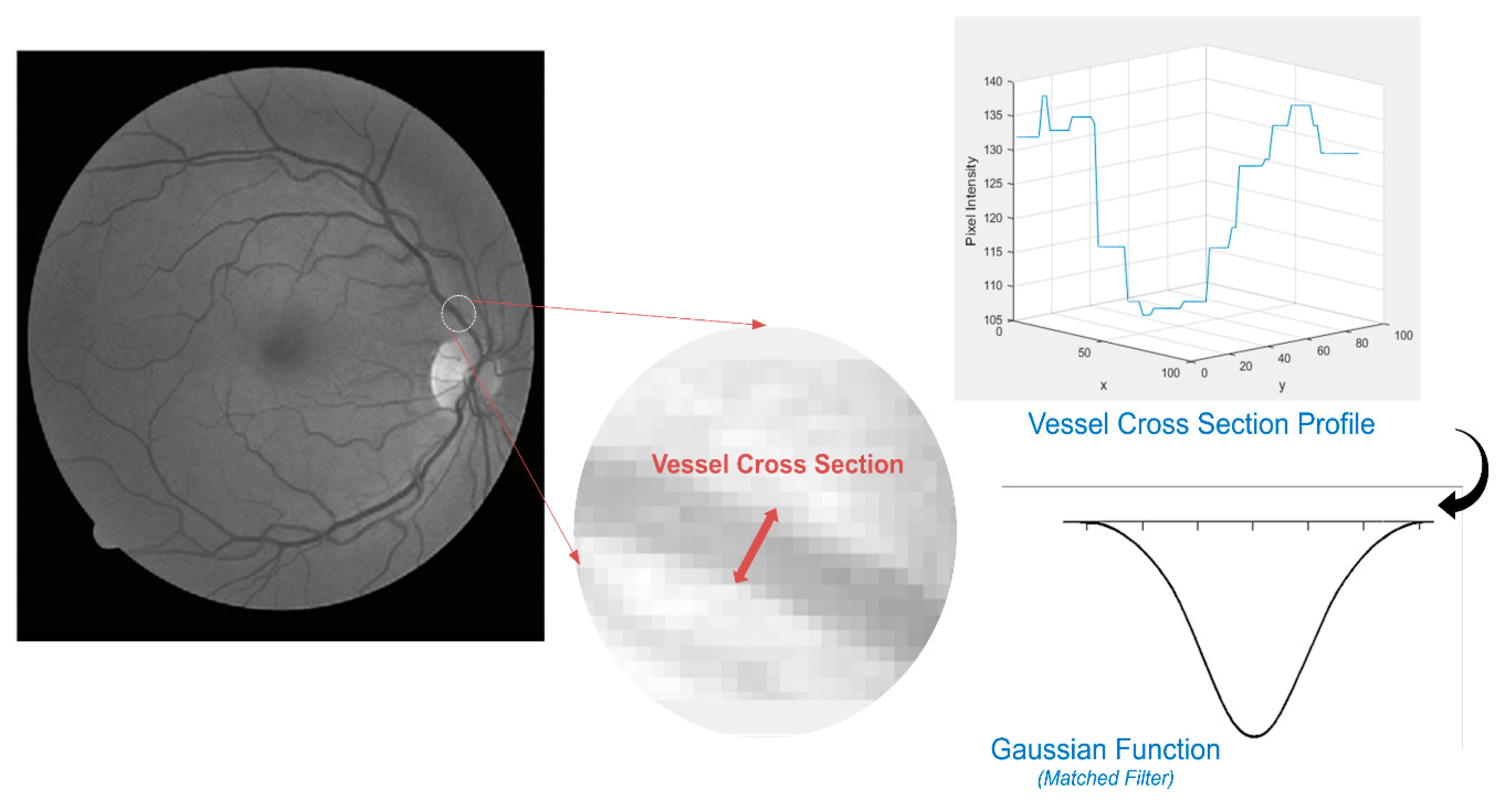 Retinal Vessels Segmentation Techniques and Algorithms: A Survey