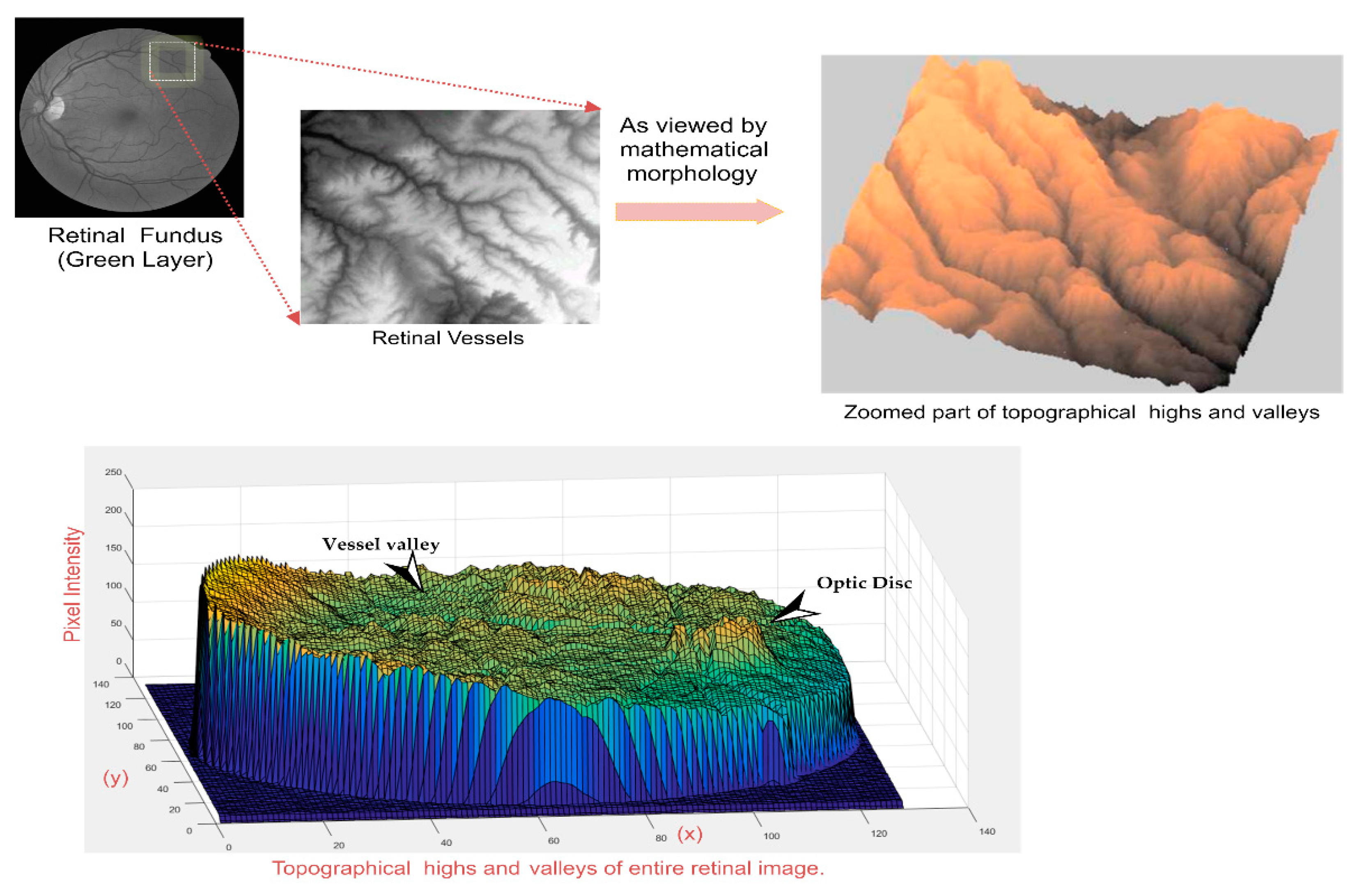 Retinal Vessels Segmentation Techniques and Algorithms: A Survey