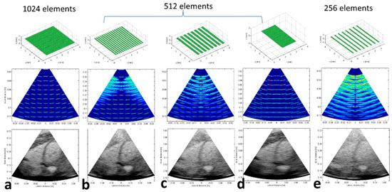 Fast Volumetric Ultrasound B-Mode and Doppler Imaging with a New High ...