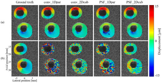 Applied Sciences | Special Issue : Ultrafast Ultrasound Imaging
