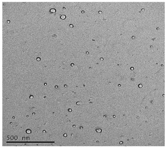 Neuroprotective Investigation of Chitosan Nanoparticles for Dopamine ...