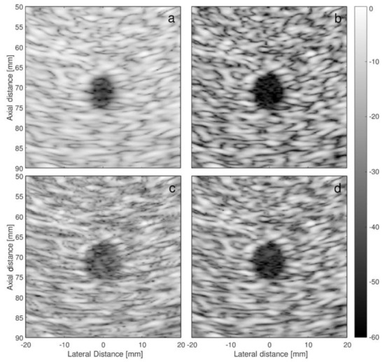 Applied Sciences | Special Issue : Ultrasound B-mode Imaging ...