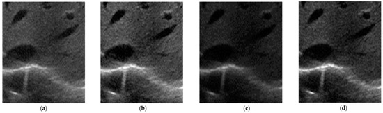 Applied Sciences | Special Issue : Ultrasound B-mode Imaging ...