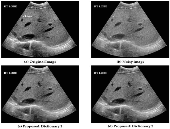 Applied Sciences | Special Issue : Ultrasound B-mode Imaging ...