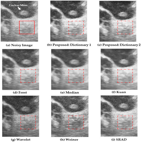 Applied Sciences | Special Issue : Ultrasound B-mode Imaging ...