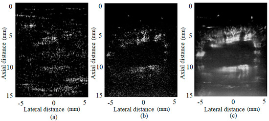 Applied Sciences | Special Issue : Ultrasound B-mode Imaging ...