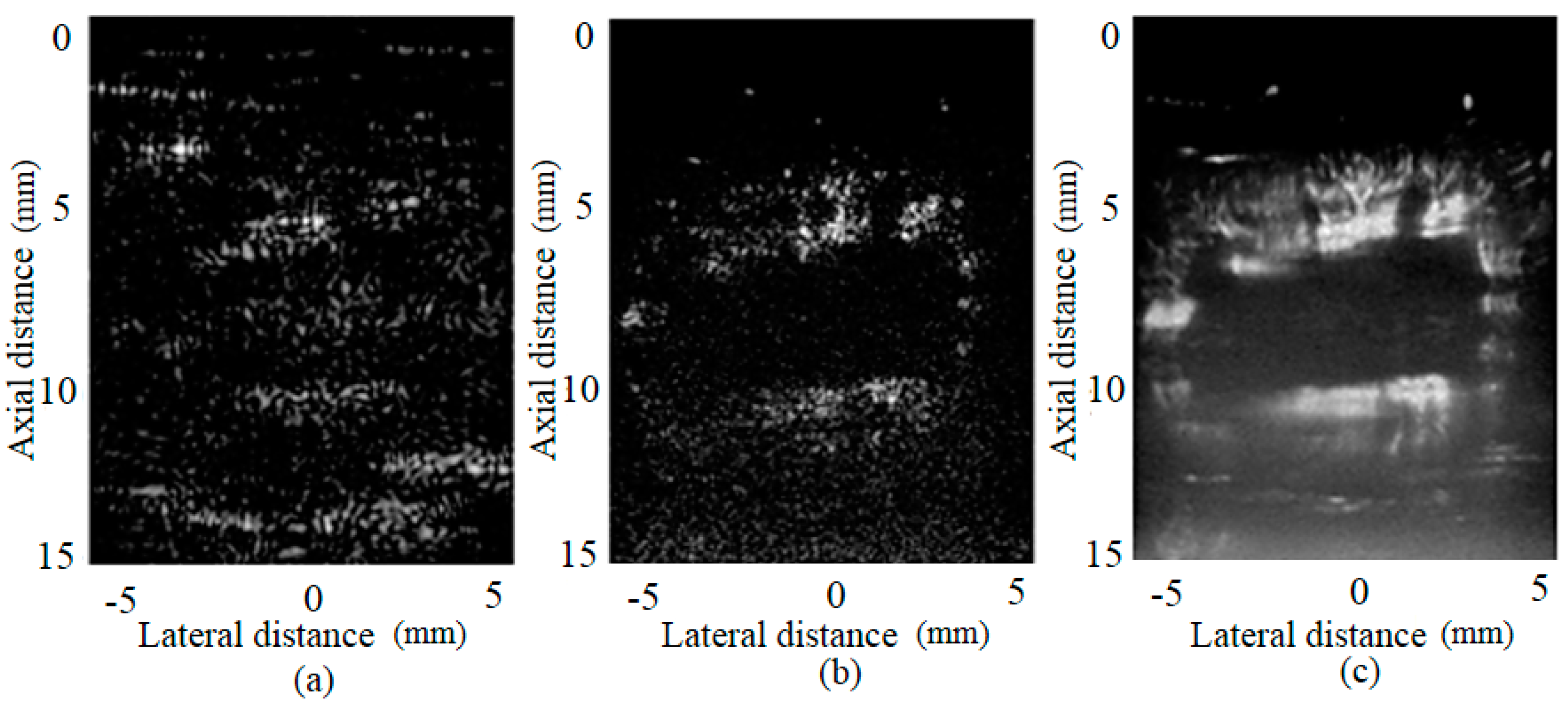 A High-Efficiency Super-Resolution Reconstruction Method for Ultrasound ...