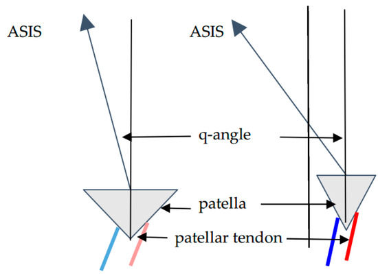 A Novel Method for Assessing Regional Tendon Stiffness and Its Significance