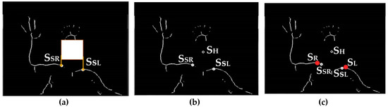 An Upper Extremity Rehabilitation System Using Efficient Vision-Based ...