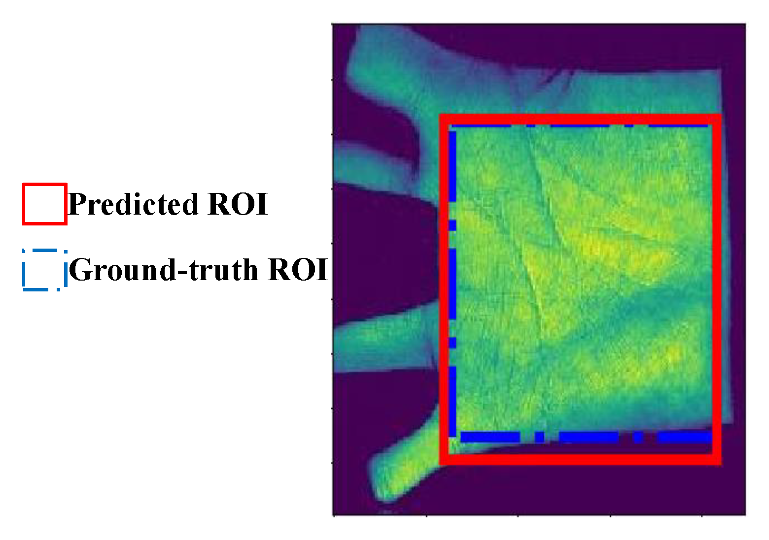 Deep Region of Interest and Feature Extraction Models for Palmprint Verification Using ...