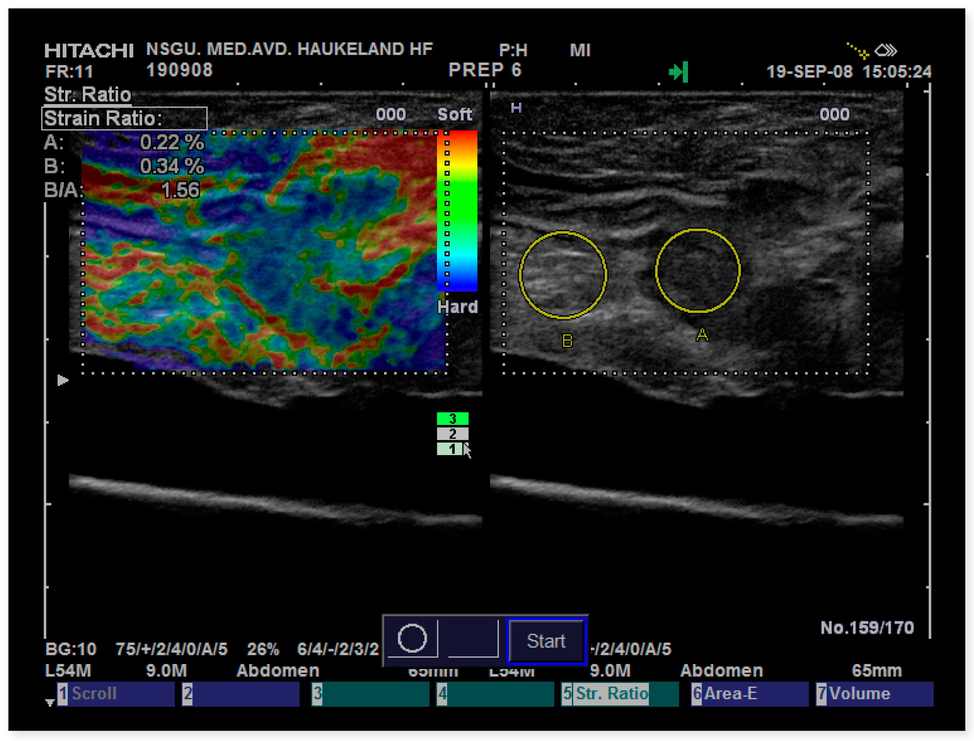 Applied Sciences | Free Full-Text | Strain Ratio as a Quantification ...