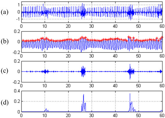 Movement Noise Cancellation in Second Derivative of Photoplethysmography Signals with Wavelet ...