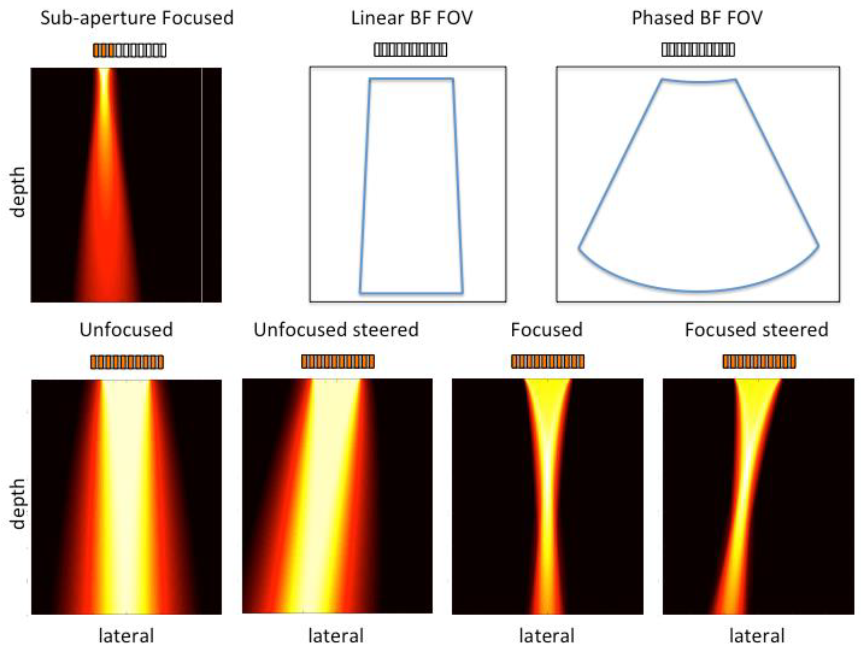 Methods Of Ultrasound Beam Focusing The Best Picture Of Beam