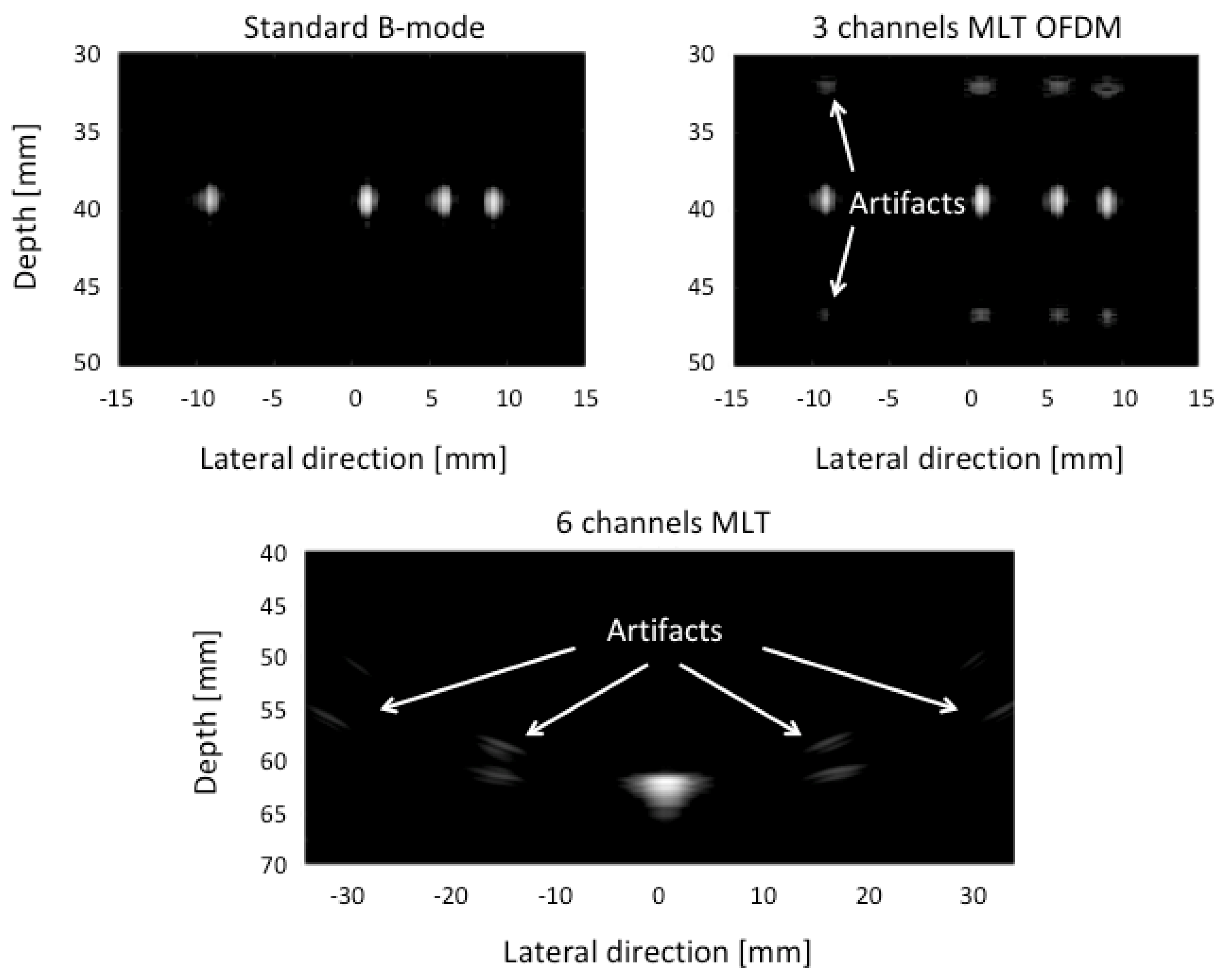 Practical Guide to Ultrasound Beam Forming: Beam Pattern and Image ...