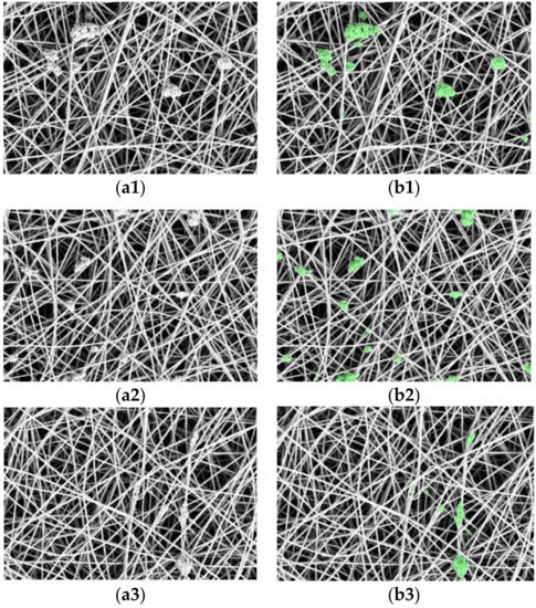 Automatic Metallic Surface Defect Detection and Recognition with Convolutional Neural Networks