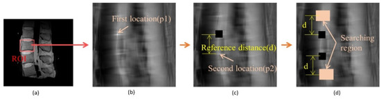Semi-Automatic Segmentation of Vertebral Bodies in MR Images of Human ...