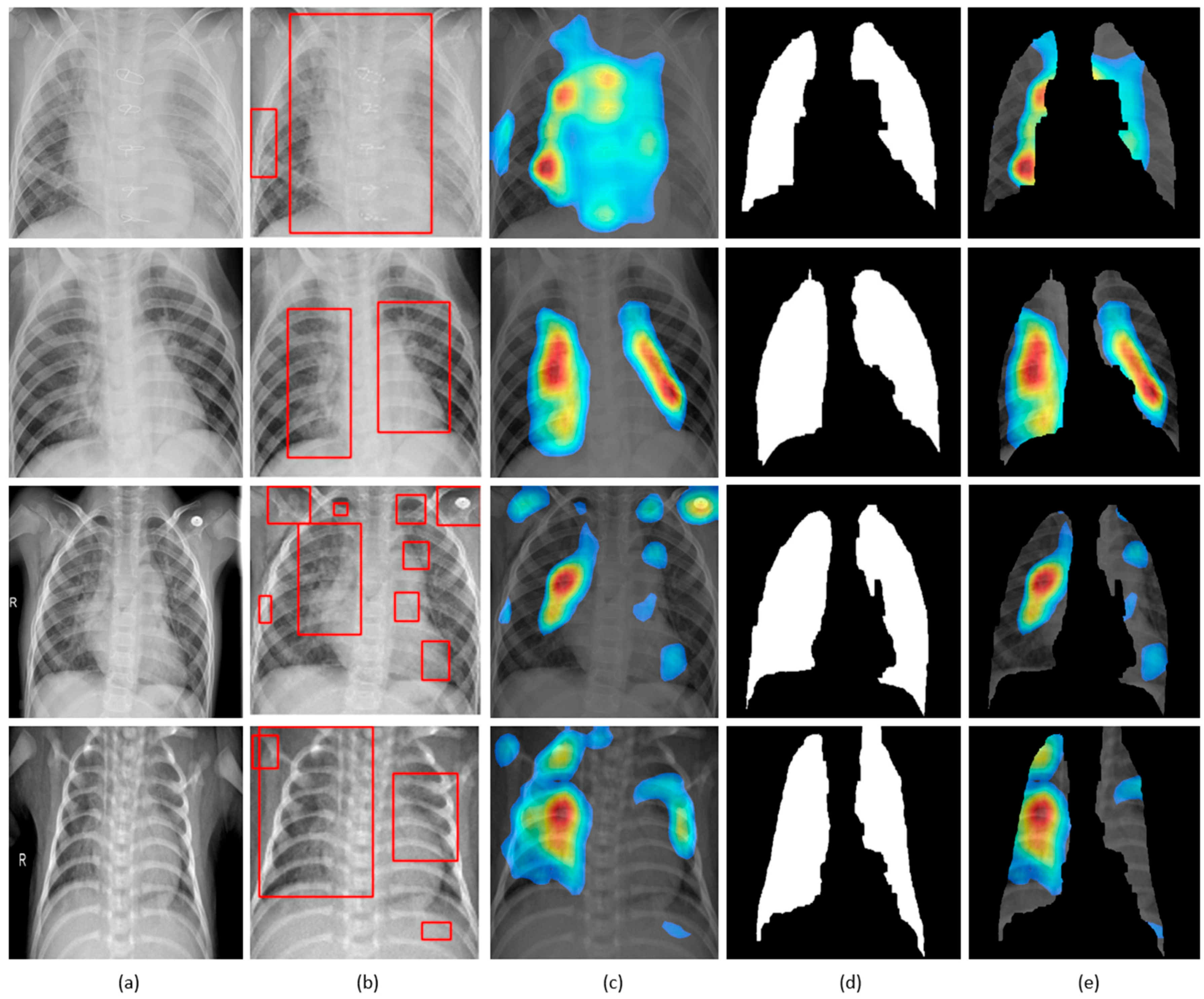 Visualization and Interpretation of Convolutional Neural Network Predictions in Detecting ...