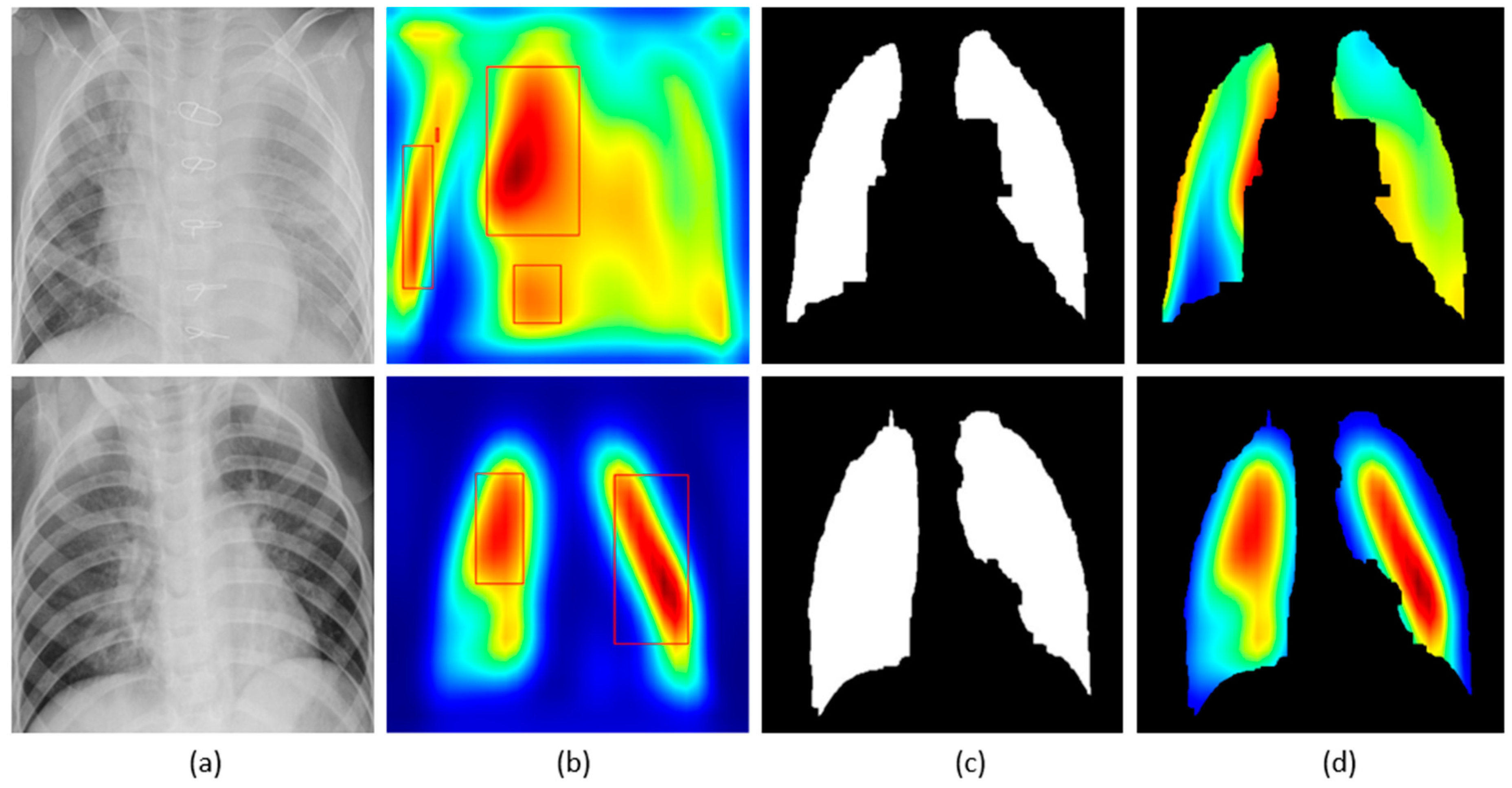 Visualization and Interpretation of Convolutional Neural Network Predictions in Detecting ...
