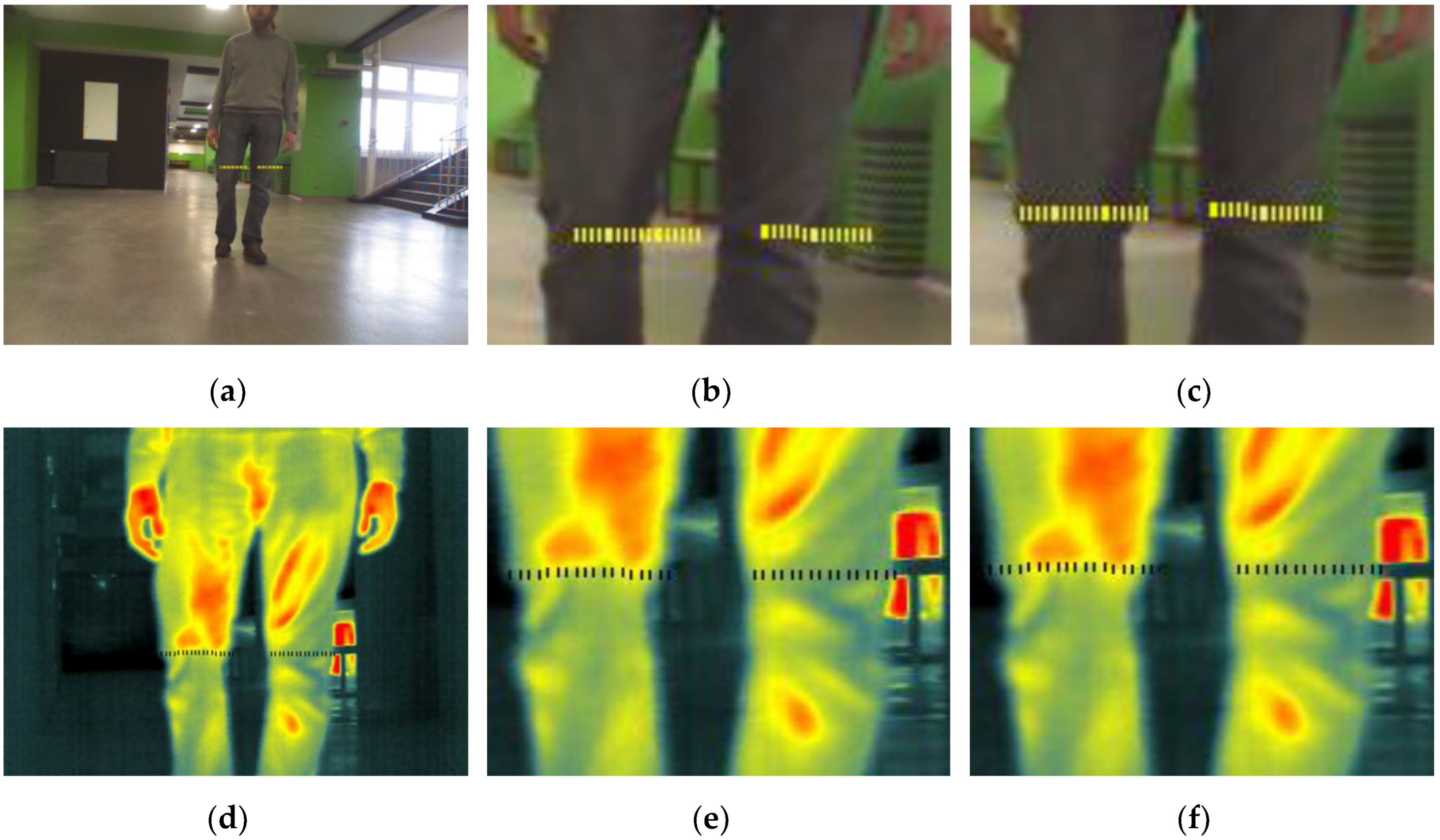 Improved Human Detection with a Fusion of Laser Scanner and Vision ...