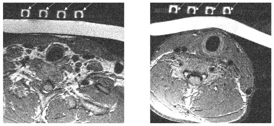 Applied Sciences | Special Issue : Ultrasound B-mode Imaging ...