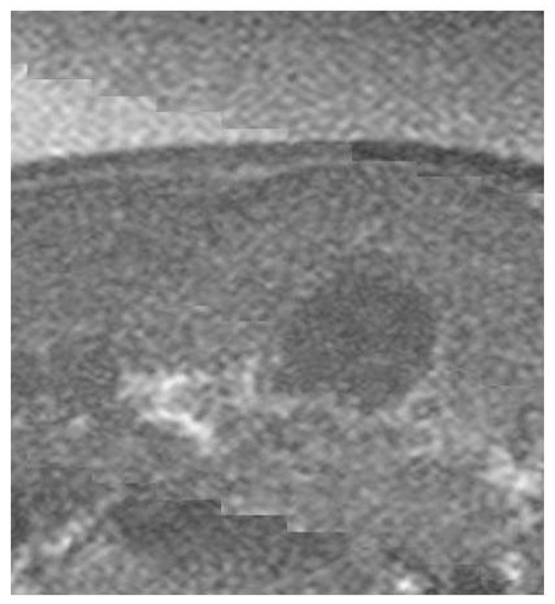 Applied Sciences | Special Issue : Ultrasound B-mode Imaging ...