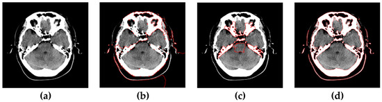 An Image Segmentation Method Based on Improved Regularized Level Set Model