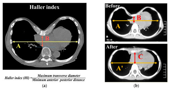 Computer-Aided Design and Manufacturing Technology for Identification ...